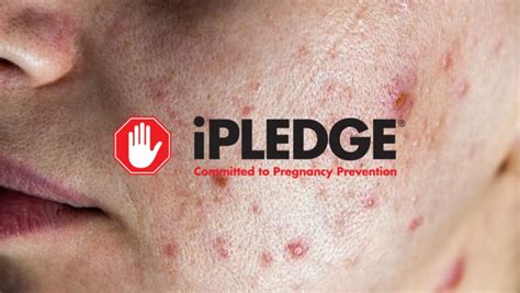 Understanding Ipledge When Starting Accutane Dermondemand