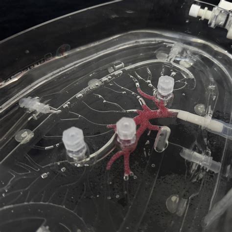 Pulmonary Embolism Model And 3d Simulation Surgeonslab