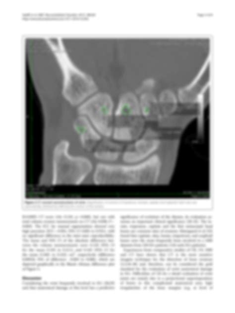 Solution Validity Of A Computer Assisted Manual Segmentation Software