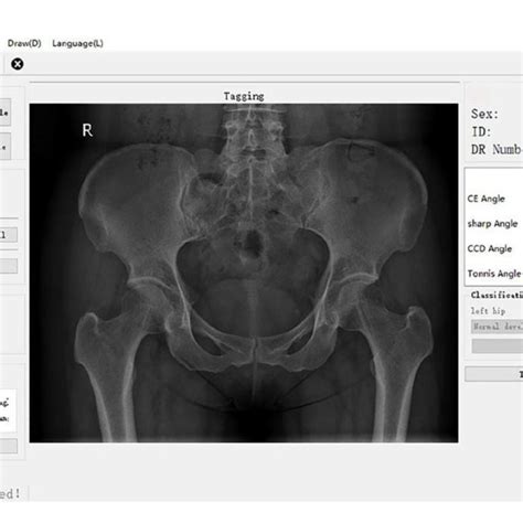 Graphical User Interface Of The Computer Aided Detection System Download Scientific Diagram