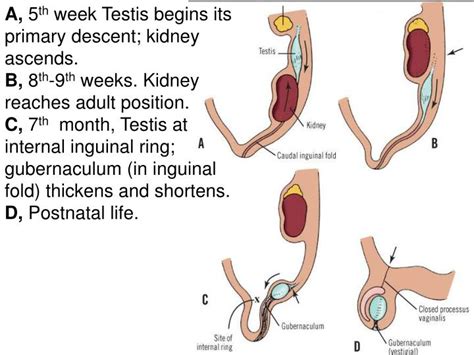 Ppt Undescended Testis Powerpoint Presentation Id 250379