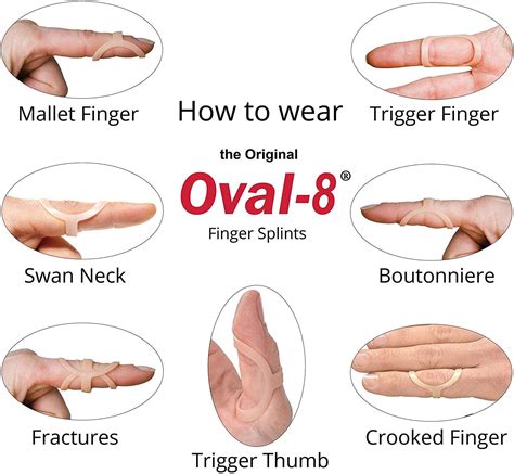 Oval 8 Finger Splints Sizing Set Music Strong