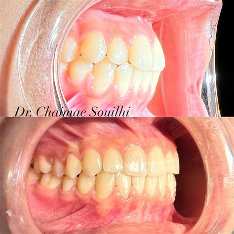 Dr Chaimae Souilhi Dr Chaimae Souilhi • Instagram Photos And Videos