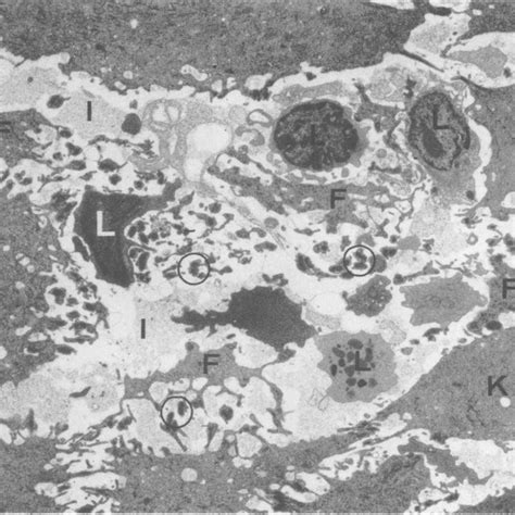 Electron Micrograph Of The Dermoepidermal Junction A Fenestrated Download Scientific Diagram