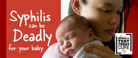 Syphilis Congenital South Dakota Department Of Health