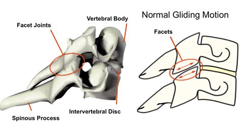 Facet Joint Test At Sheila Sparks Blog
