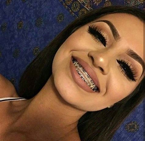 50 Best Braces Colors For Girls 
