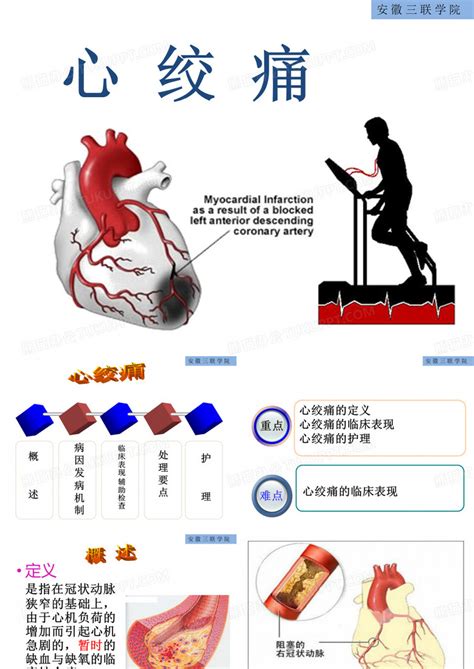 心绞痛PPT模板下载 编号lmmomrjy 熊猫办公