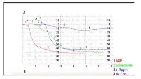 Platelet Function Tests