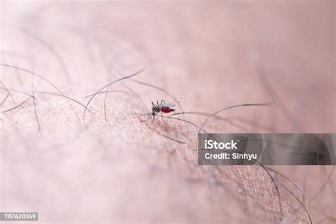 클로즈 업 애 데 아 이집트 티 인간의 피부에 일반적인 집 모기 혈액 인간을 빠는 애 들 이집트 티 가득 찬에 대한 스톡 사진 및 기타 이미지 Istock