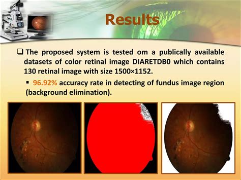 Automatic Detection Of Diabetic Maculopathy From Fundus Images Using