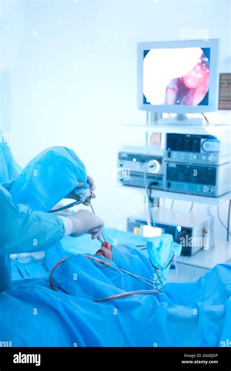 Polype Dans Le Nez Banque De Photographies Et Dimages à Haute