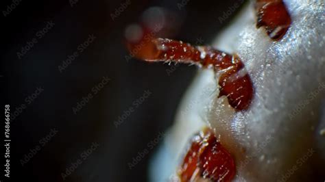 Extreme Magnification Of A Ticks Body As It Moves Its Limbs And