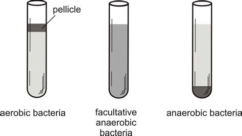 4 Types Of Growth With A Nutrient Broth Download Scientific Diagram