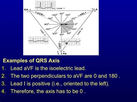 4th Part Ecg Basics Cardiac Axis Dr Salah Mabrouk Khallaf Ppt