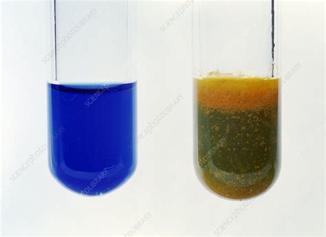 Fehlings Reaction Stock Image A5000270 Science Photo Library