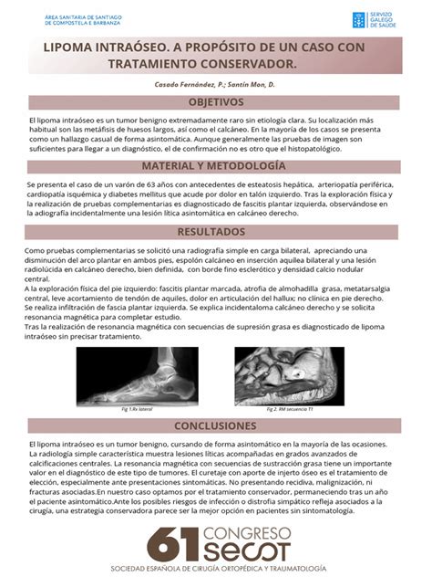 Lipoma Intraóseo Secot Pdf Medicina Medicina Clinica