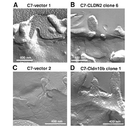 Freeze Fracture Electron Microscopy Of Tj Strands Freeze Fracture
