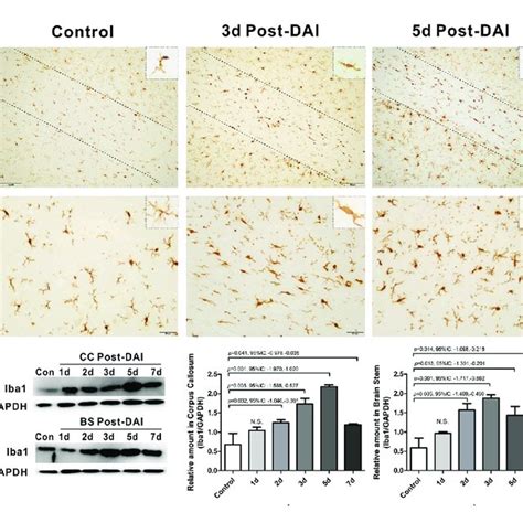Activation Of Microgliamacrophages In Dai A Immunohistochemical
