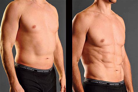 Давай После Операции На Пресс Фото — Фото Картинки