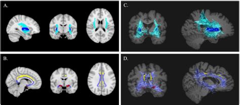 The Templates For The Lateral A And Medial B Tracts In Mni Space Download Scientific