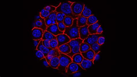 Radioactive Gel Implant Eliminates Pancreatic Tumors In 80 Of Mice