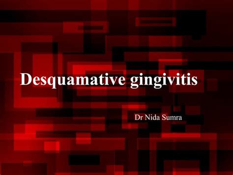 Necrotizing Ulcerative Gingivitis Pptx Dental Health Diseases And