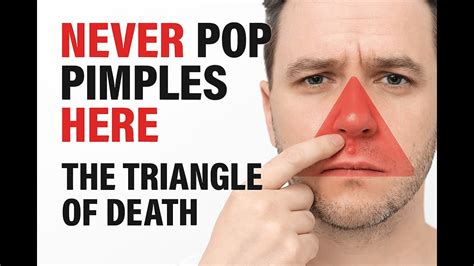 Never Pop Pimples Here The Triangle Of Death Youtube