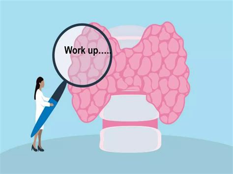 Approach To Thyroid Nodule Pptx
