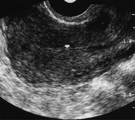 Pelvic Quiz Flashcards Quizlet