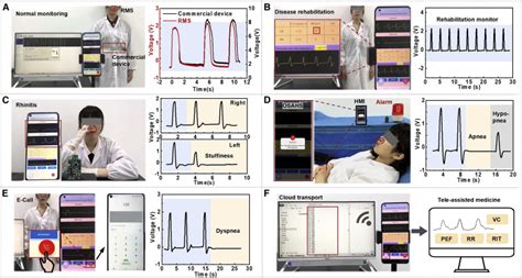 Integrated Wearable Smart Sensor System For Real Time Multi Parameter Respiration Health