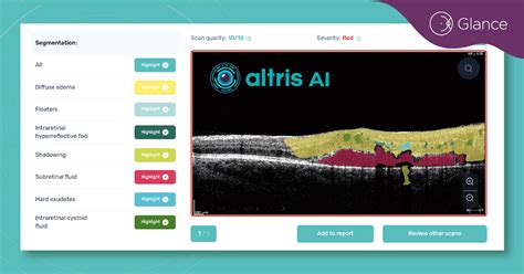Fda Grants Altris Ims Platform 510 K Clearance