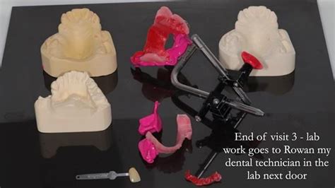 Finlays Newsletter 60 Sylvias Upper Kennedy Class 2 Mod 1 Metal Based Upper Rpd Finlay