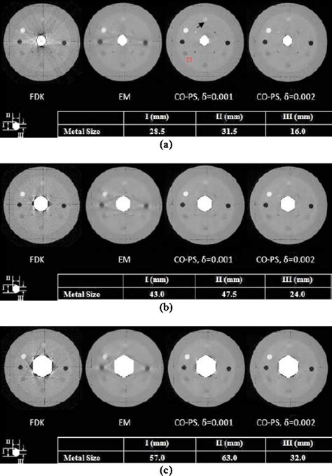 Figure 1 From Metal Artifact Reduction In X Ray Computed Tomography Ct By Constrained