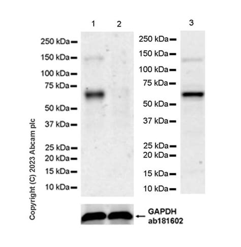 E2f1重组抗体 Epr26698 49 E2f1抗体ab314312 Abcam中文官网