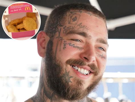 Rapper Post Malone Dropped A 600 000 Diamond Embedded In His Tooth