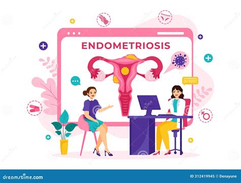 Endometriosis Vector Illustration With Condition The Endometrium Grows