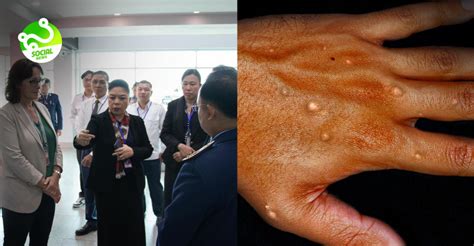 អស់ពីកូវីដ ចូលដល់អឹមផក ក្រសួង ត្រៀមរៀបចំទីតាំងផ្នែកចត្តាឡីស័ក នៅព្រលានយន្តហោះ Sabay News