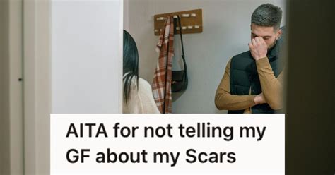His Girlfriend Wont Stop Pressuring Him To Tell Her About His Scars