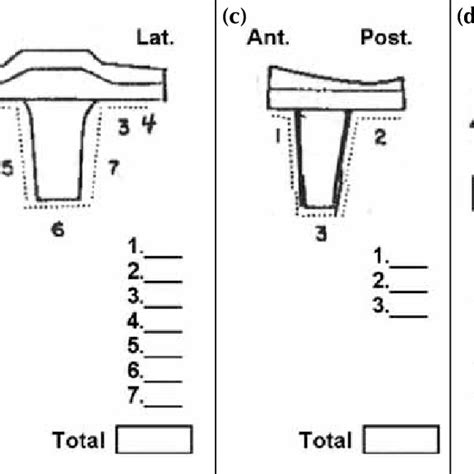 The Knee Society Total Knee Arthroplasty Roentgenographic Evaluation