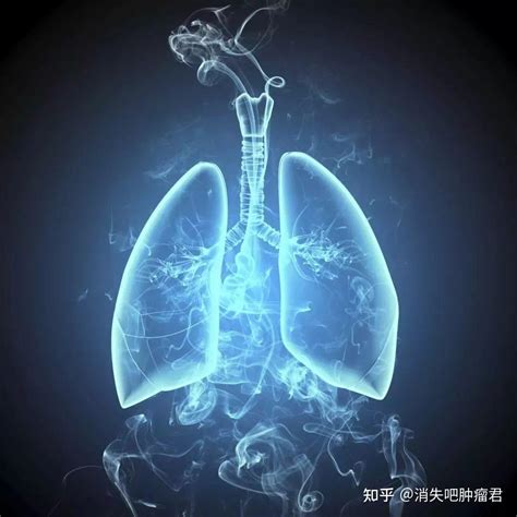 癌症从早期到晚期要多久？ 知乎