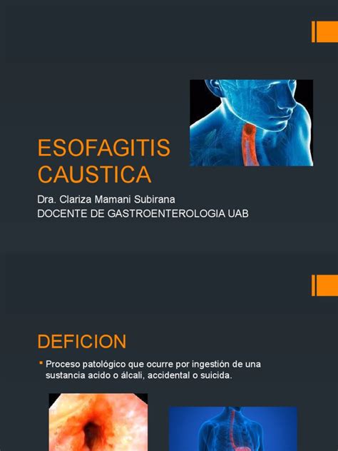 1 Esofagitis Caustica Pdf Medicina Causas De La Muerte