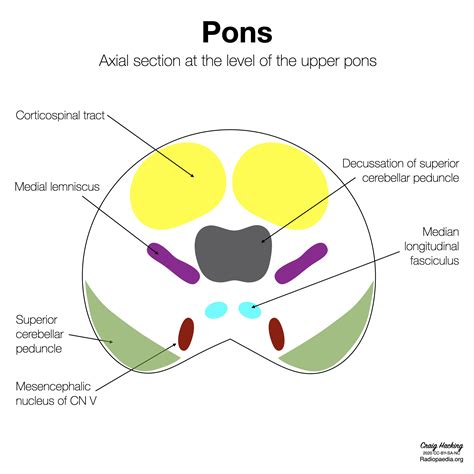 Pons Diagram
