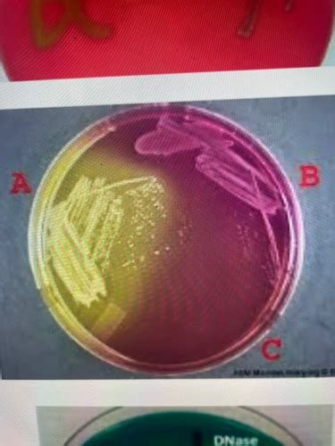 Staphylococcus Flashcards Quizlet