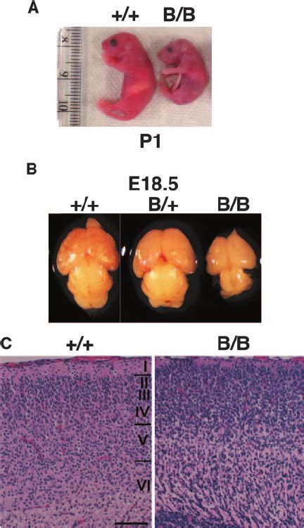 Mutant Bip Mice Exhibit An Outside In Pattern Of Neocortical Layer Download Scientific Diagram