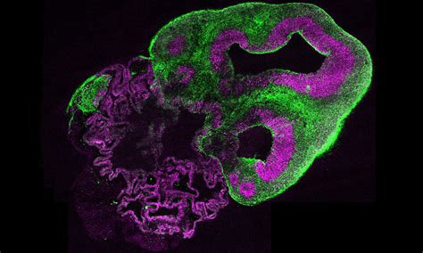 How One Scientist Is Growing Miniature Brains In Her Lab