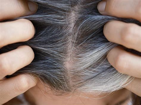 The Causes Of Gray Hair And How To Care For It