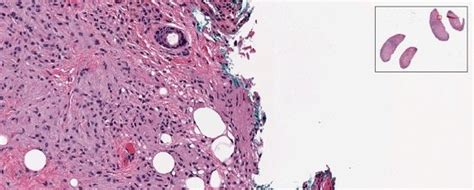 First Steps · Qupathqupath Wiki · Github