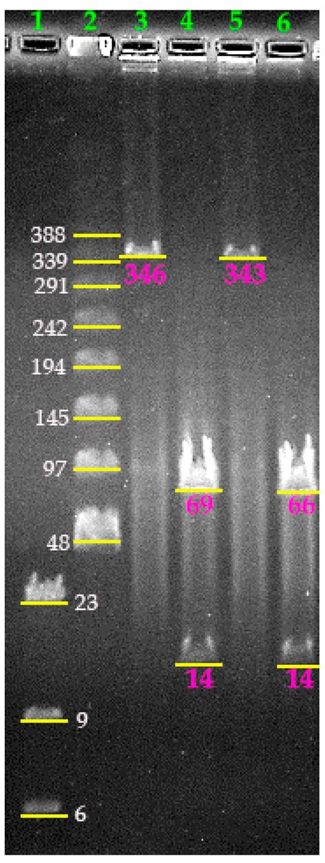 Actuators Free Full Text Development Of Vibratory Microinjection System For Instantaneous