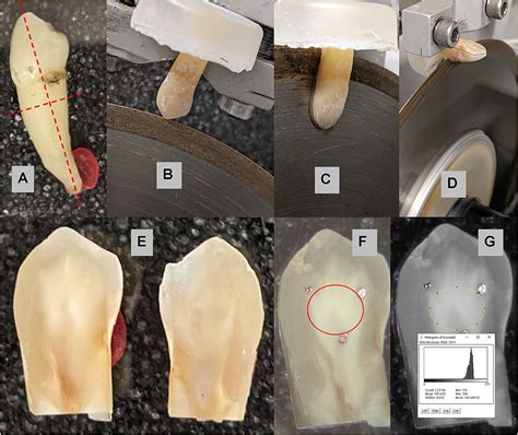 Frontiers Effect Of Temperature On Tooth Staining By 52 Off